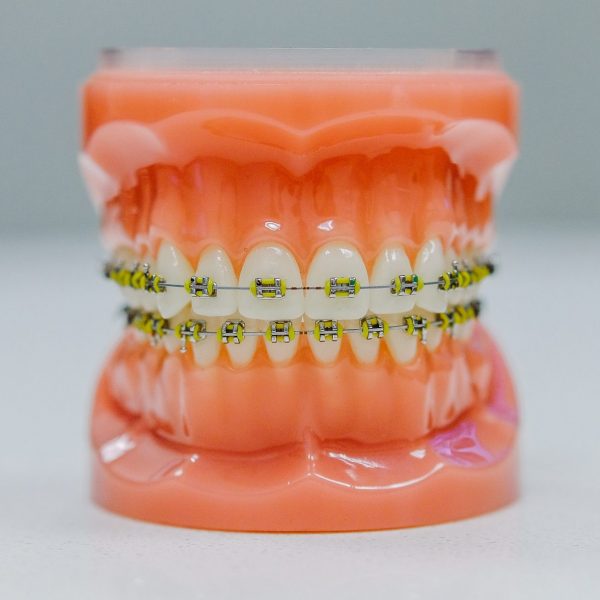 Du Raan Orthodontics | Orthodontic Practice in Tygervalley | Cape Town